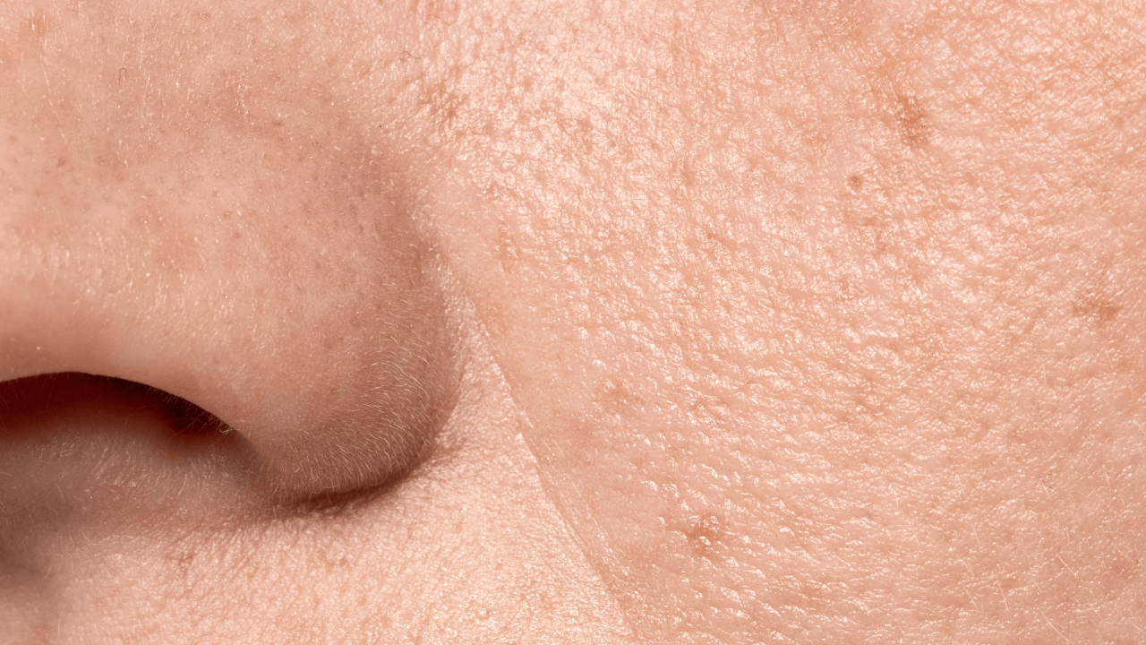How to Reduce Bumpy Skin: Your Complete Guide to Smoother Texture ...